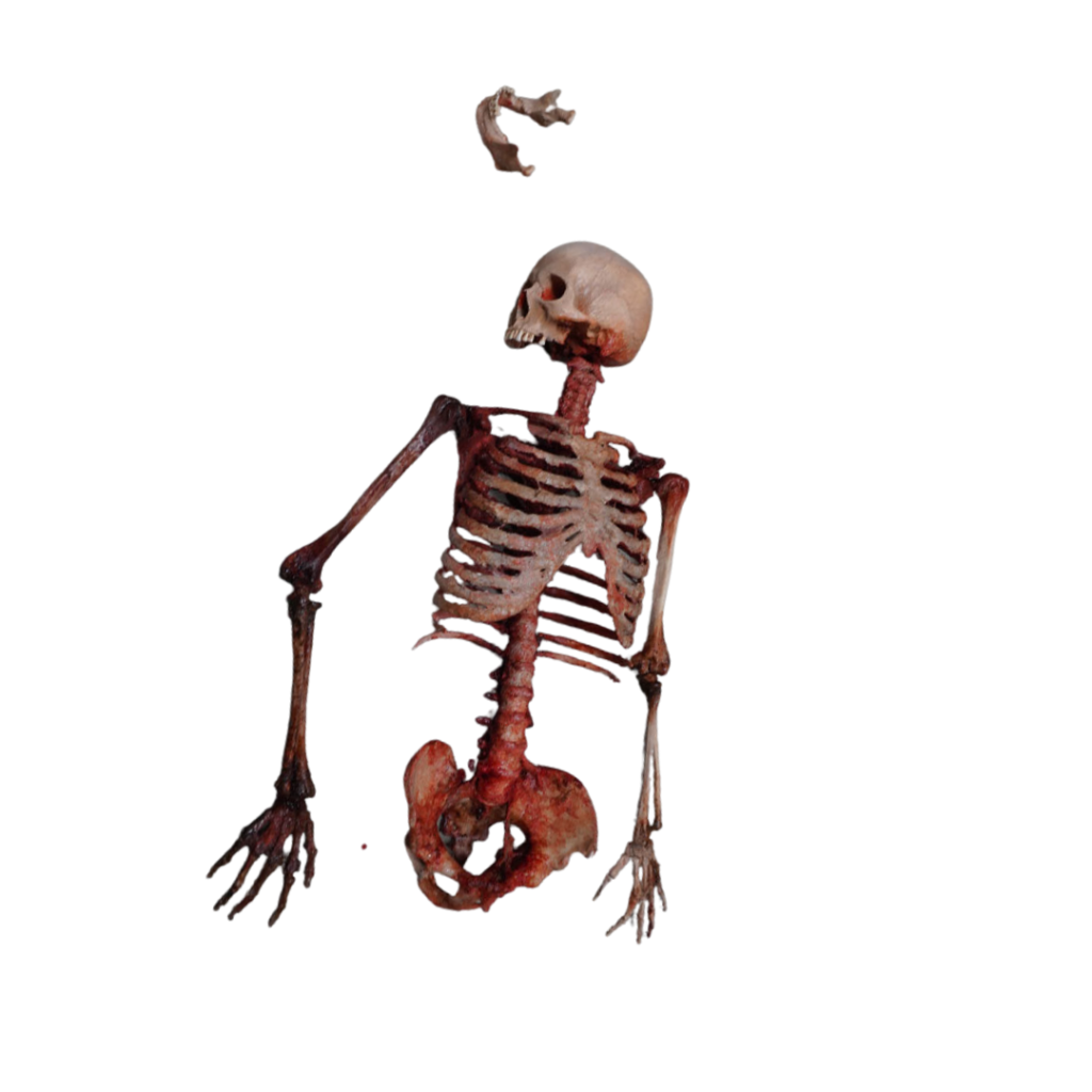 Burnt Skeleton Cadaver – Tetra Scene Of Crime